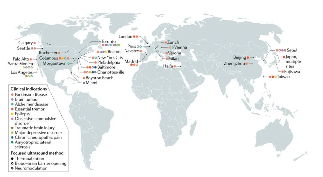 Nature Review Neurology聚焦超声在大脑中的应用：从热消融到药物输送 - 超微科学仪器